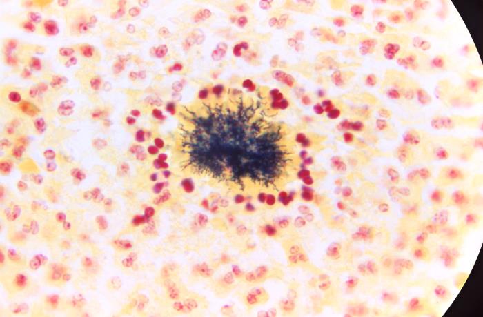 Details - Public Health Image Library(PHIL)